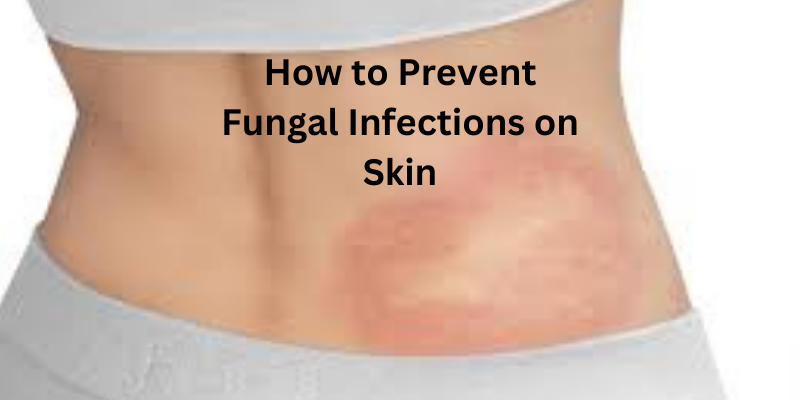 Fungal Infection: Types, Causes, Symptoms, Diagnosis and Treatments ...